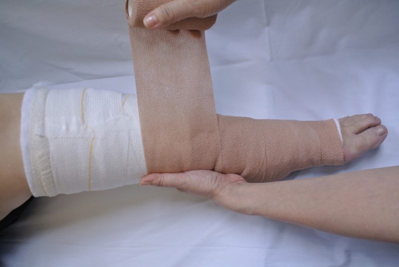 Combined Decongestive Therapy - Lymphedema Society of Singapore